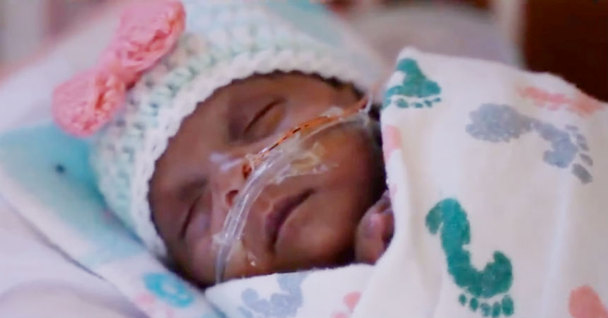 Saybie, la guagua más pequeña del mundo: pesó menos de 250 gramos ...