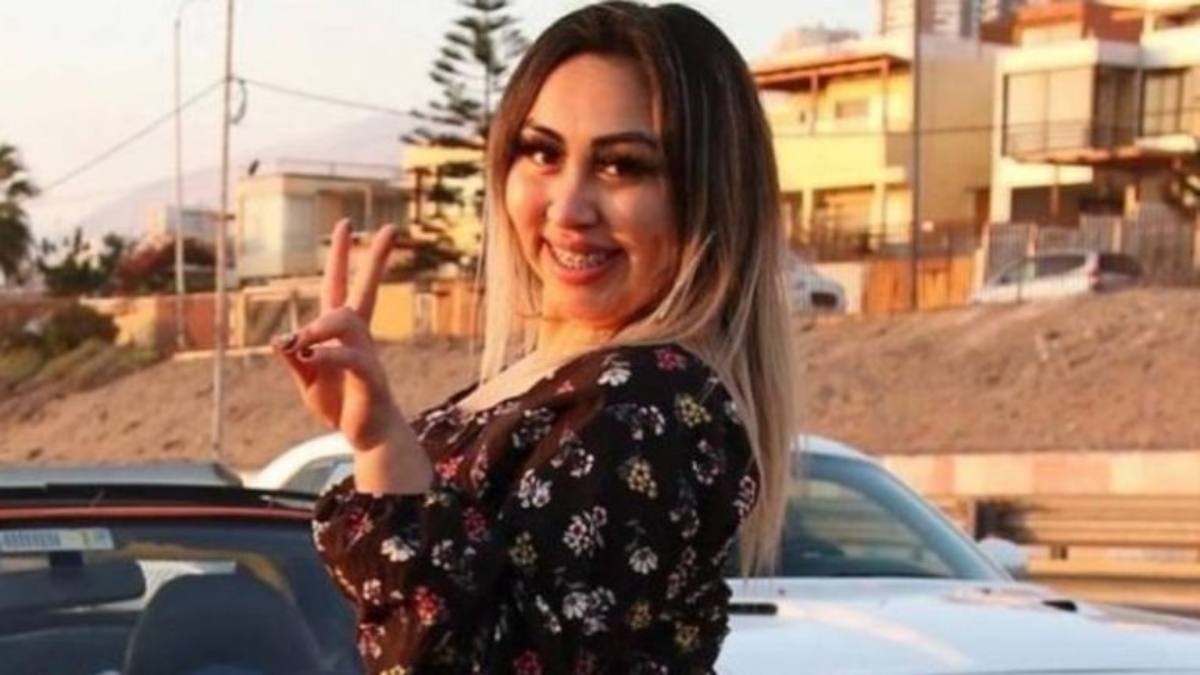 Naya Fácil: Cómo quedó tras realizarse varias operaciones — Radio Corazón