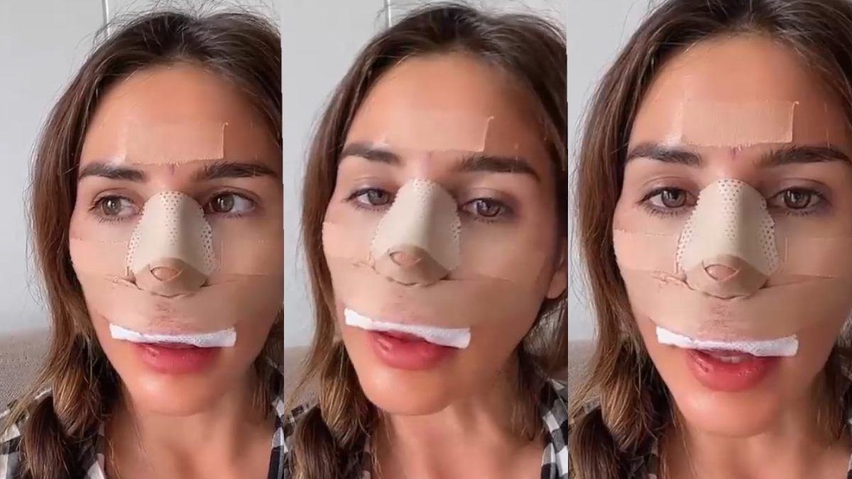 Fran Undurraga indignada tras cirugía en la nariz: "Gente tan hija de ...