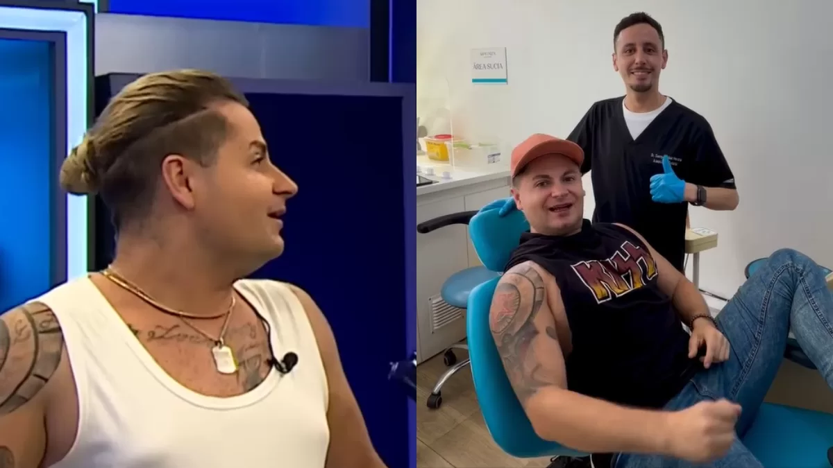 Princeso impacta con modificación estética en su rostro antes de su ...